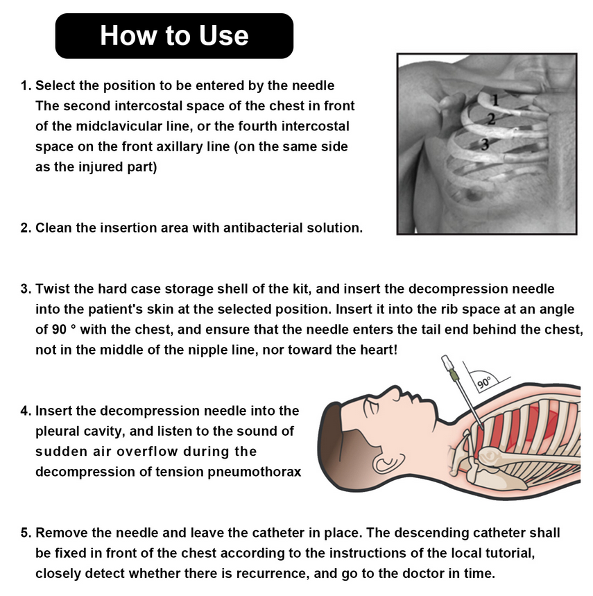 Pneumothorax Decompression Needle,Decompression Needle