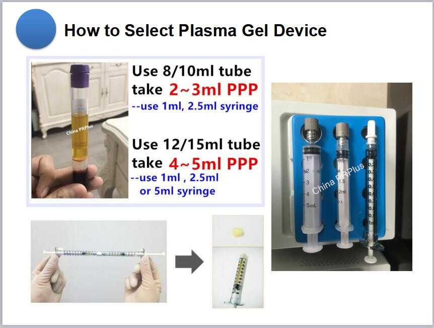 Plasma PPP Gel Biofiller Maker Plasma Gel Machine