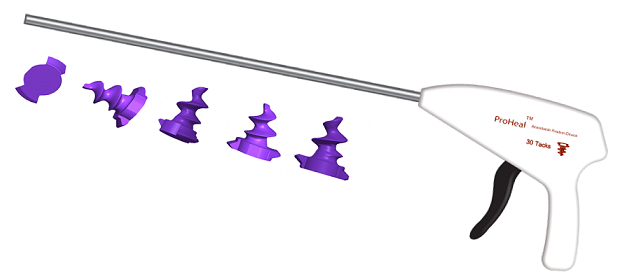 Absorbable mesh fixator,Mesh Fixation Device