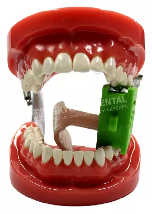 What are mouth props used for?