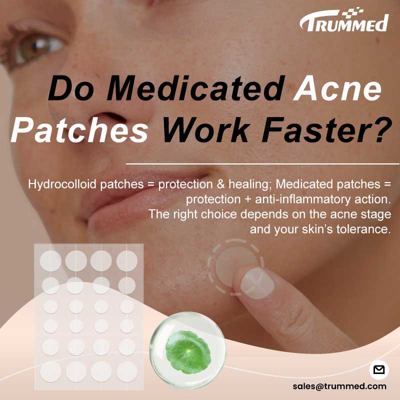 Dual Innovation in Technology and Aesthetics: Colored Microneedle Acne ...