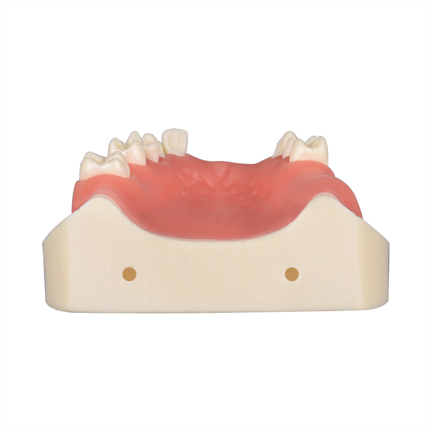 Maxillary Implant Surgery Practice Model, Missing 17, 12, 11, 21, 22 ...