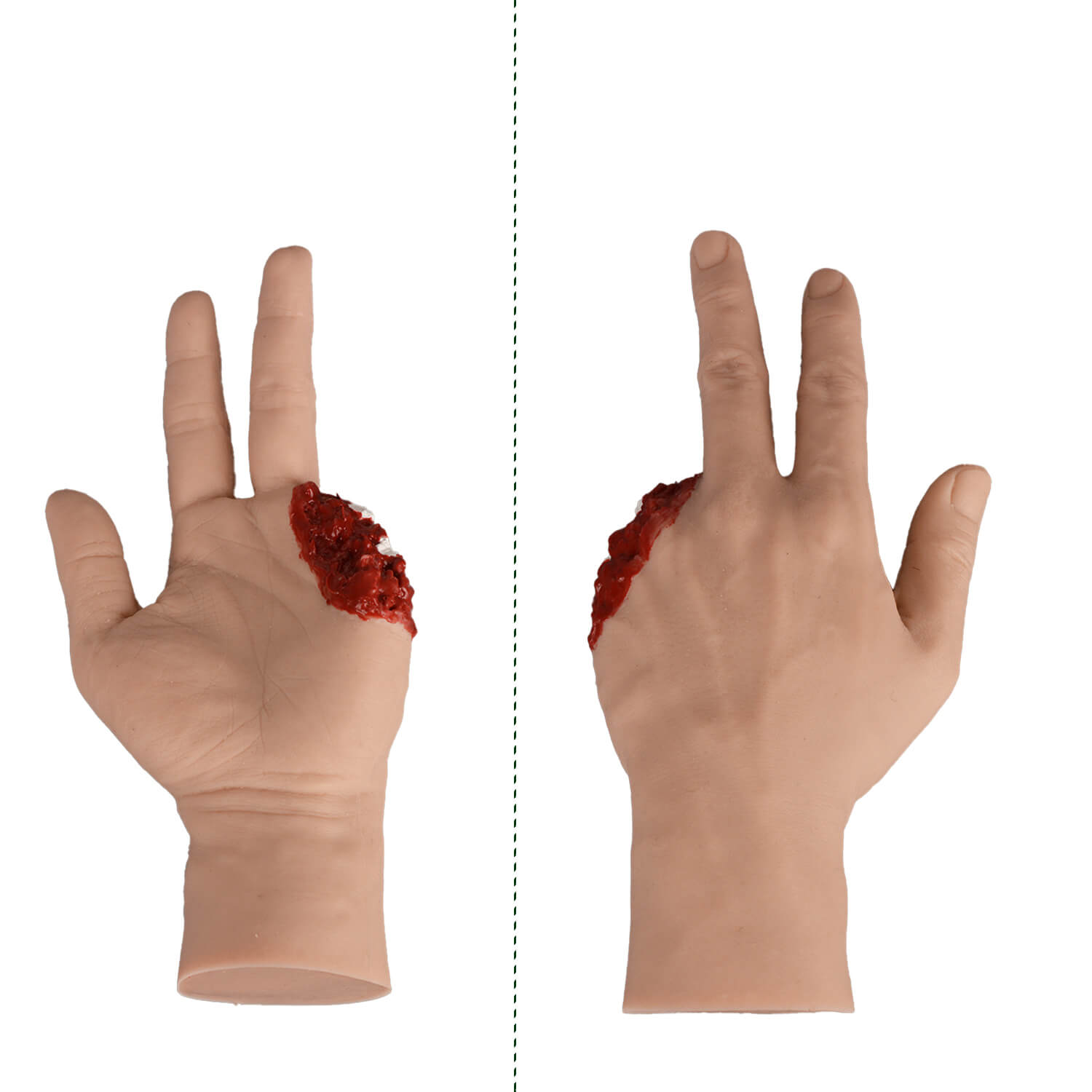 Basic Amputation Finger Trauma Wound Care Palm Model