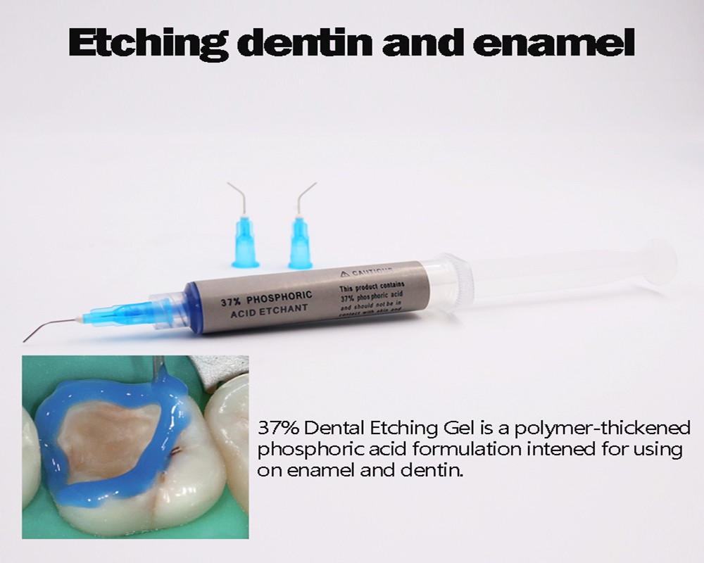 Everything You Need to Know About Dental Etching,Product New