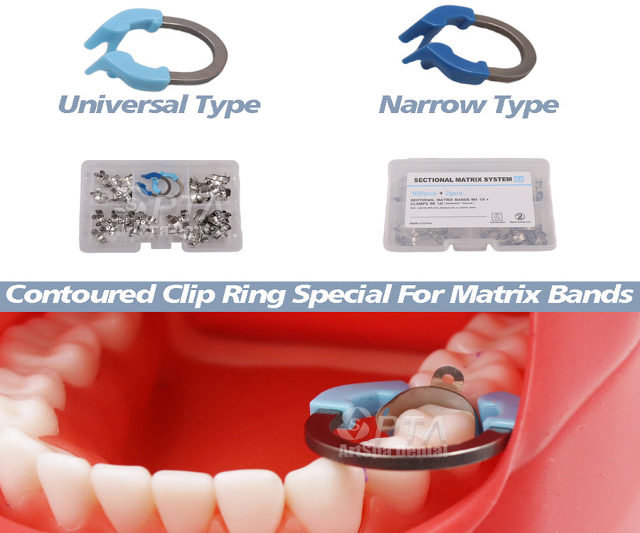 The High-Quality Dental Sectional Matrix System Bands,Product New