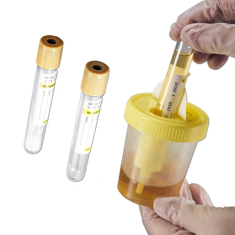 Best selling 100ml Yellow lid Urine Transfer Device Urine tube Specimen ...