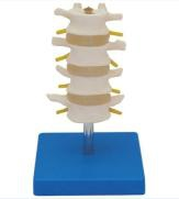 Normal lumbar spine combination (four sections),Skeletal model