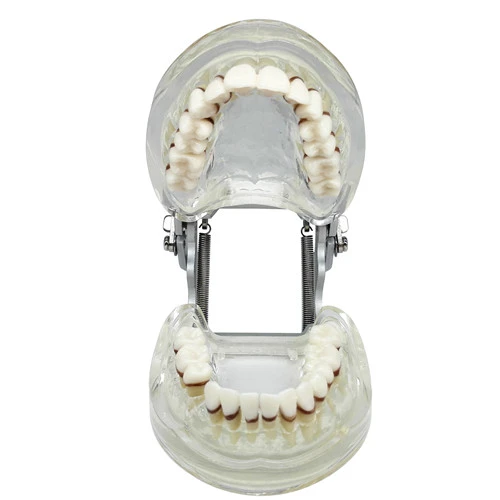 Dental Teeth Model Study Teach Standard Model Gums Removable Teeth ...