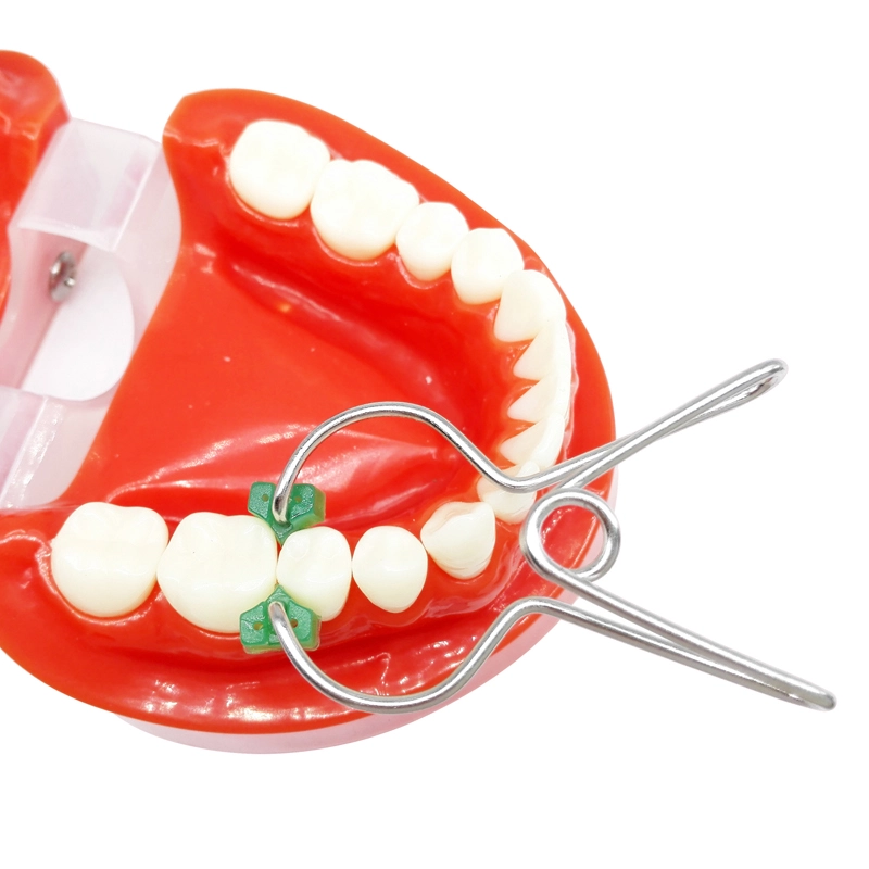 Dental Springclip for installation of sectional matrices,-Restorative