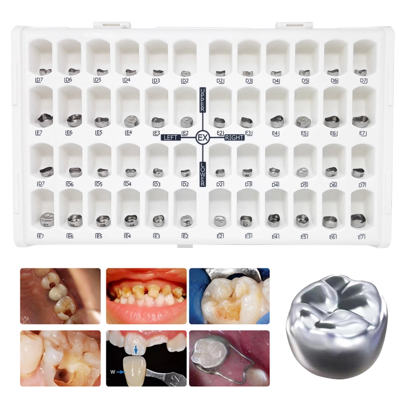48pcs Dental Kids Primary Molar Crown Stainless Steel Pediatric ...