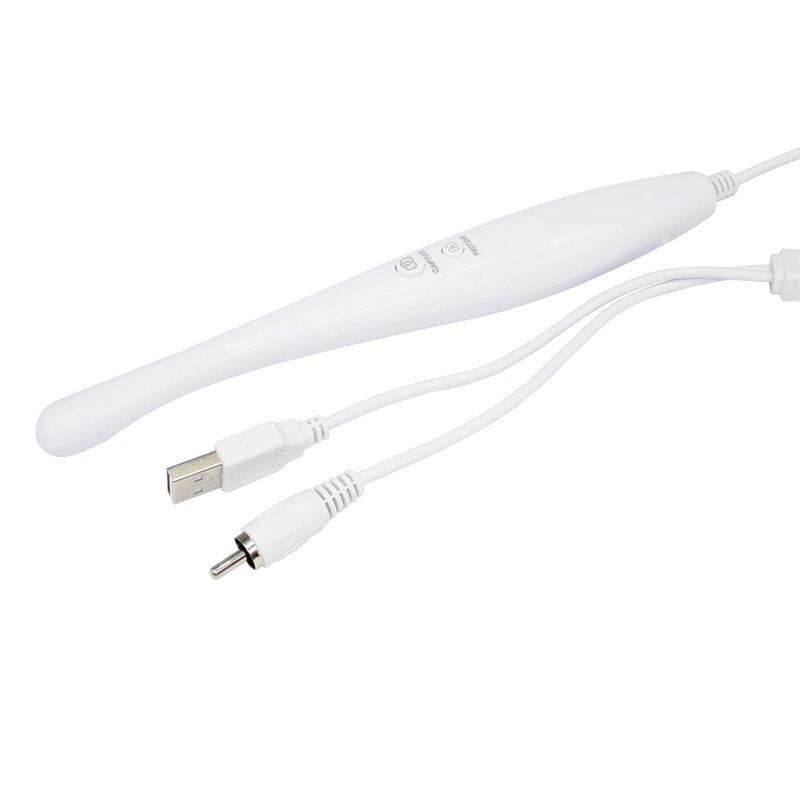 Dental DX-03AV Intraoral Camera System CMOS1/4 Embedded Operating System