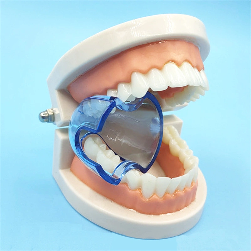 Dental Anterior/Posterior Mouth Opener Bite Prop Lip Retractor Cheek ...