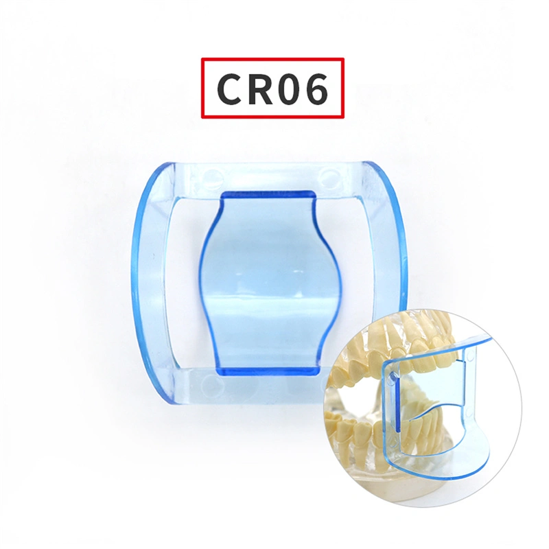 Dental Anterior/Posterior Mouth Opener Bite Prop Lip Retractor Cheek ...