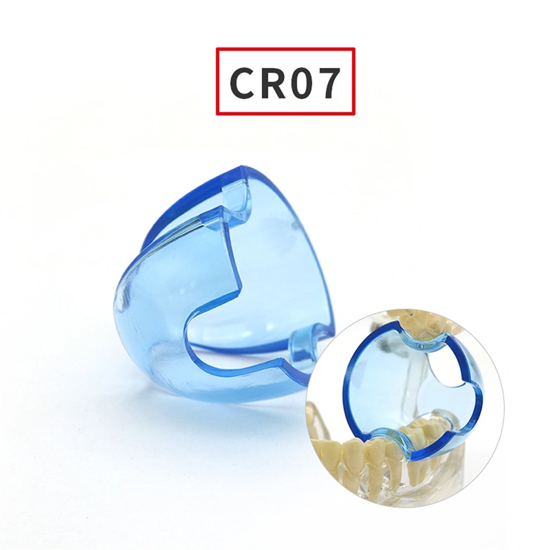 Dental Anterior/Posterior Mouth Opener Bite Prop Lip Retractor Cheek ...