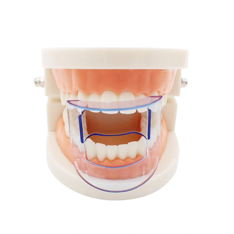 Dental Anterior/Posterior Mouth Opener Bite Prop Lip Retractor Cheek ...