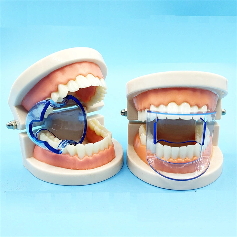 Dental Anterior/Posterior Mouth Opener Bite Prop Lip Retractor Cheek ...