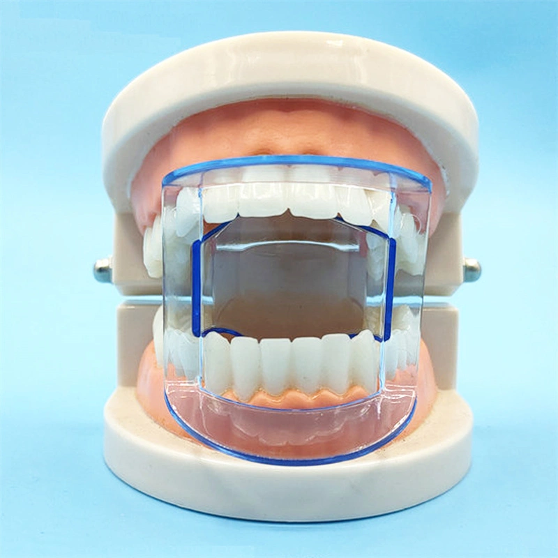 Dental Anterior/Posterior Mouth Opener Bite Prop Lip Retractor Cheek ...