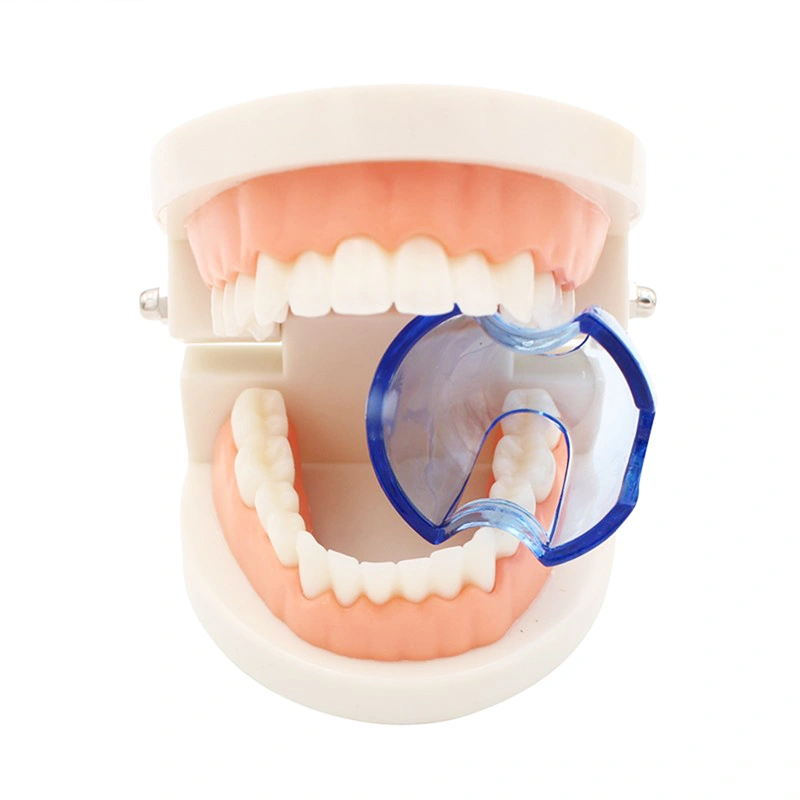 Dental Anterior/Posterior Mouth Opener Bite Prop Lip Retractor Cheek ...