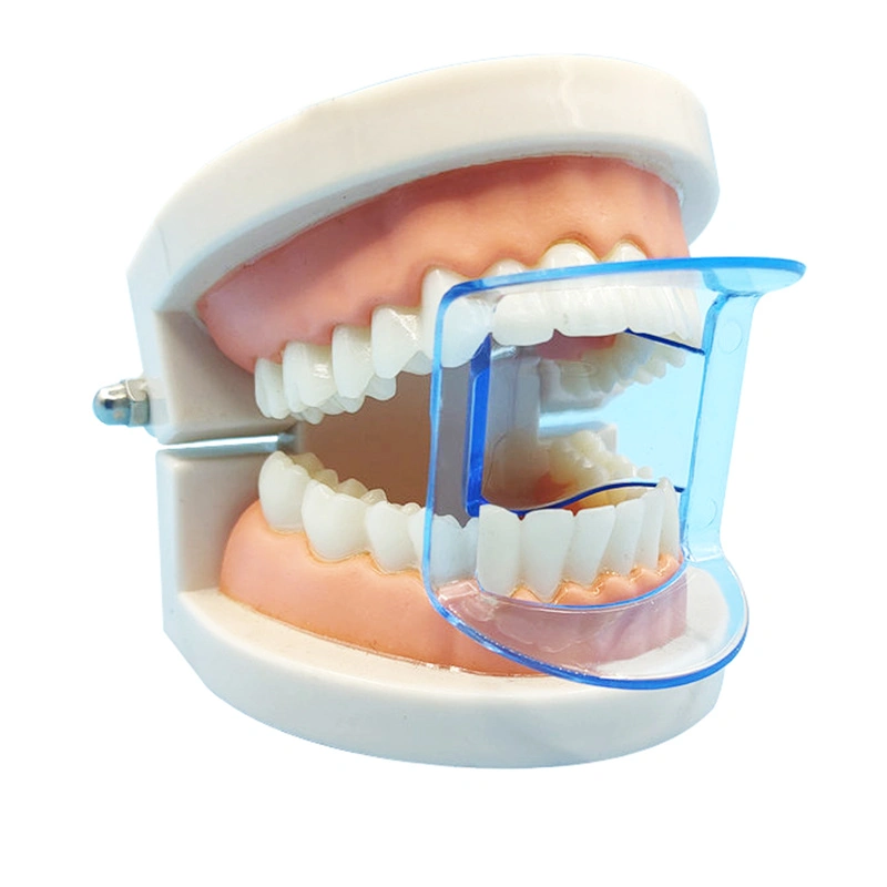 Dental Anterior/Posterior Mouth Opener Bite Prop Lip Retractor Cheek ...