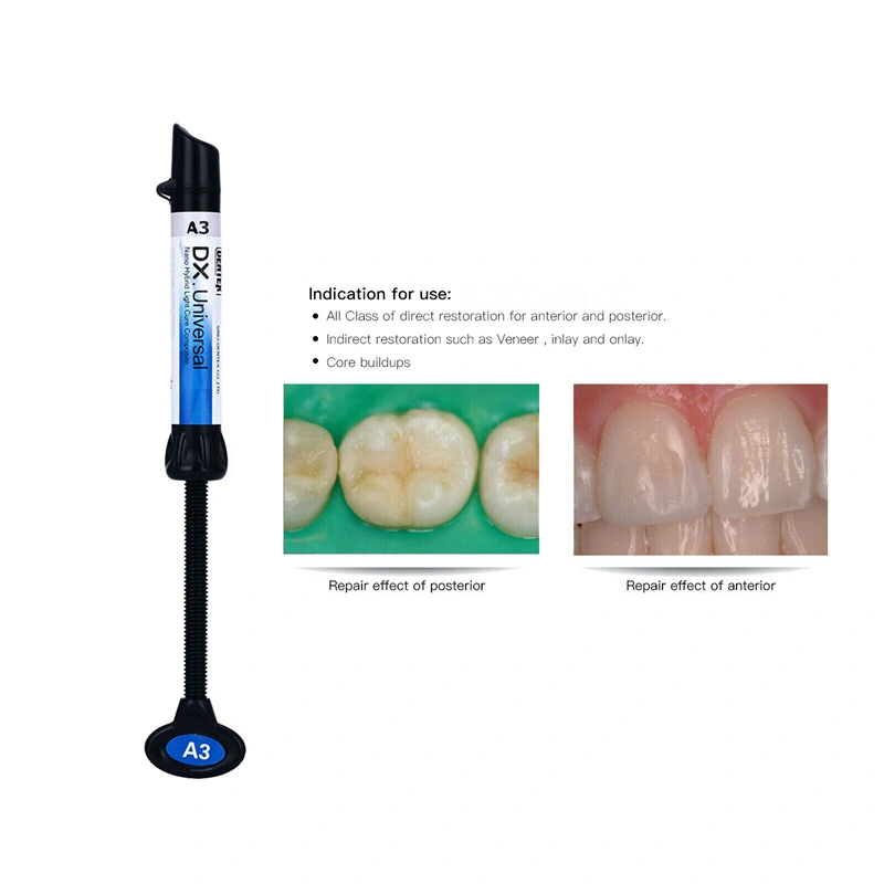DENTEX DX.Universal Dental Light Cure Composite Resin A1/A2/A3/A3.5/B1/B2/Etching Gel/Bonding ...