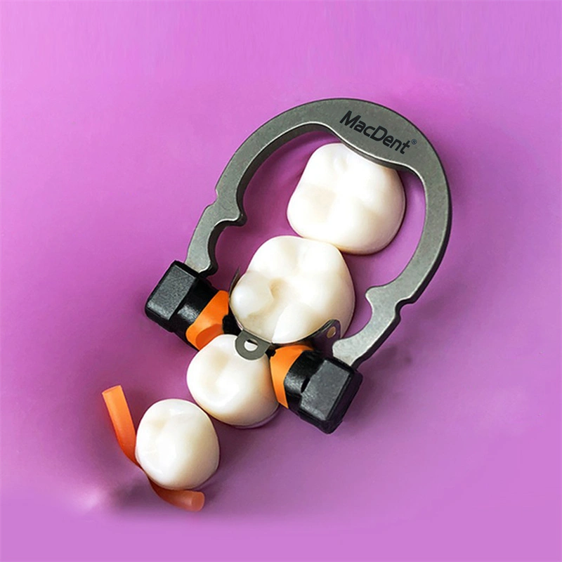 Dental Refill Matrix Narrow Ring Titanium Clamp NITI Fits Palodent ...