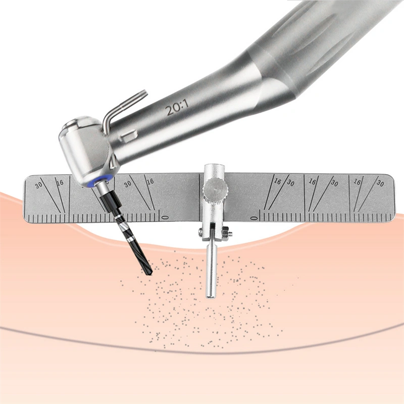 Dental Implant Locating Guide Surgical Positioning Locator Angle Ruler ...