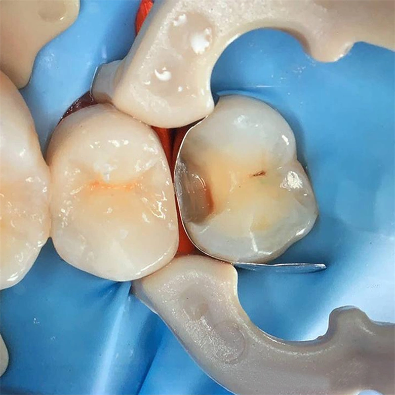 Dental Universal Resin Kerr Soft Clamp Universal Rubber Dam Sheet For ...