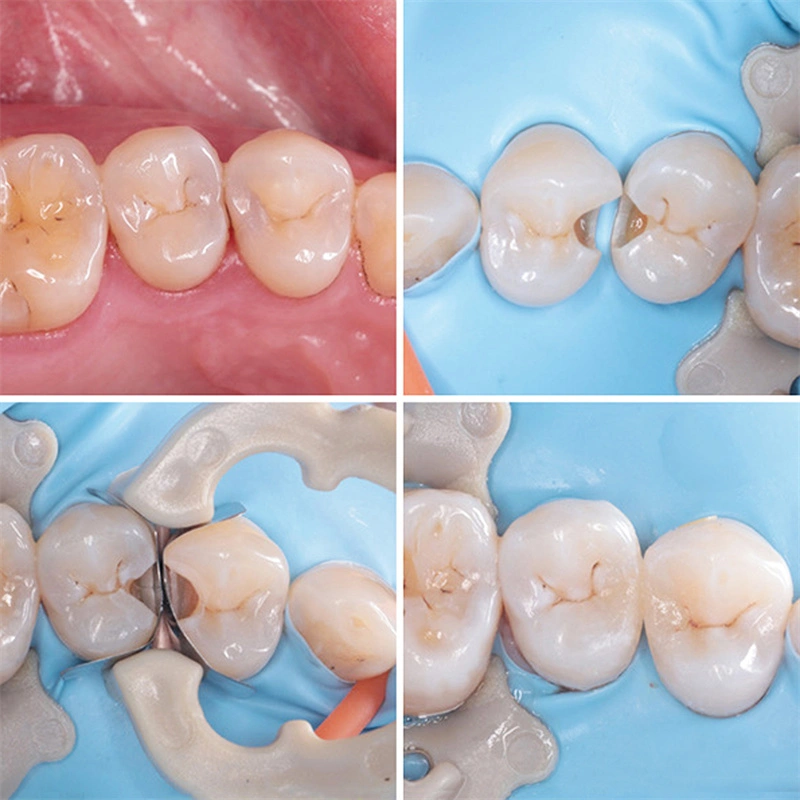 Dental Universal Resin Kerr Soft Clamp Universal Rubber Dam Sheet For ...