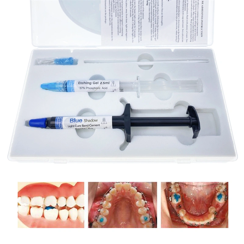 Fresh Dental Orthodontic Adhesive Light Cure Band Cement Blue Glue ...