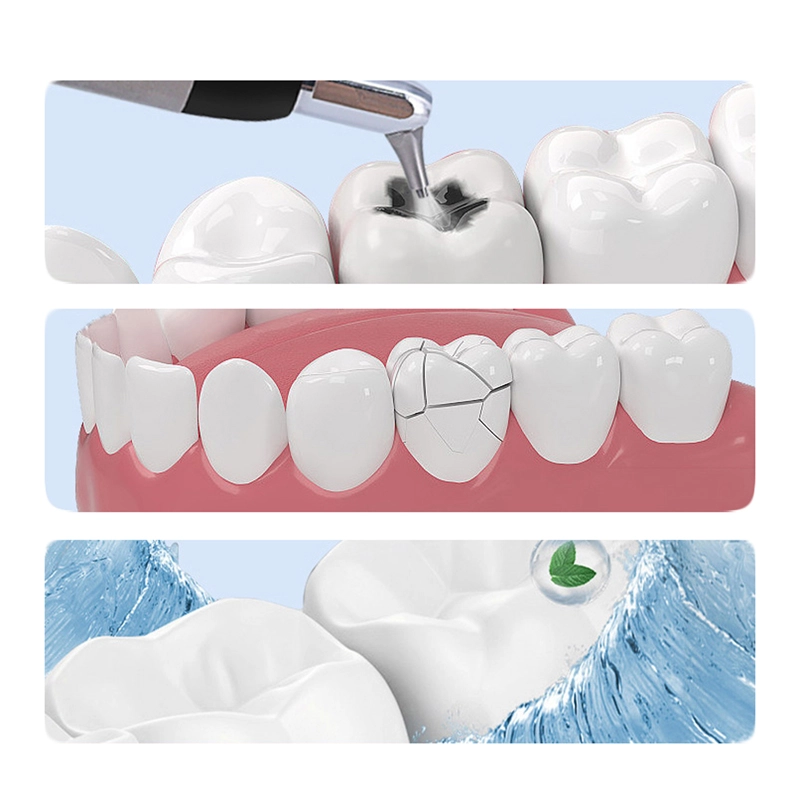 DMXDENT JP-30S M4 Dental Air Abrasion Master Alumina Sandblaster Gun with Cooling Function