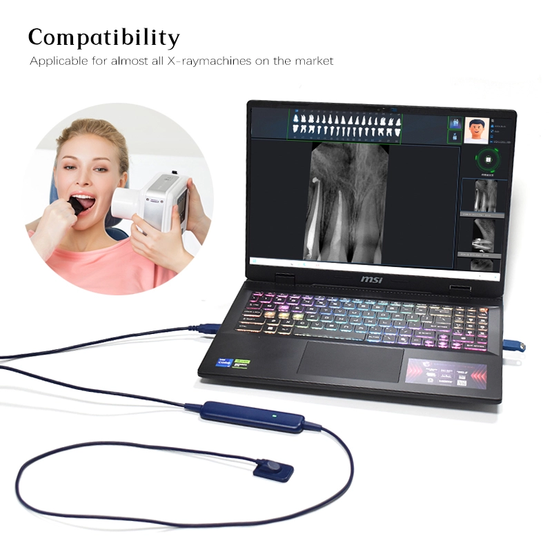 Dental CMOS / APS Digital Ray Imaging System Intraoral HD Sensor