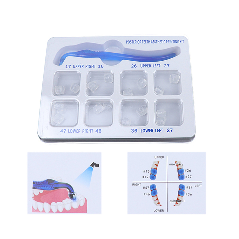 Dental Posterior Teeth Aesthetic Printing Mould Light Cure Restoration ...