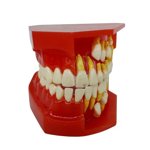 Dental Deciduous Teeth Permanent Tooth Alternate Demonstration Study ...