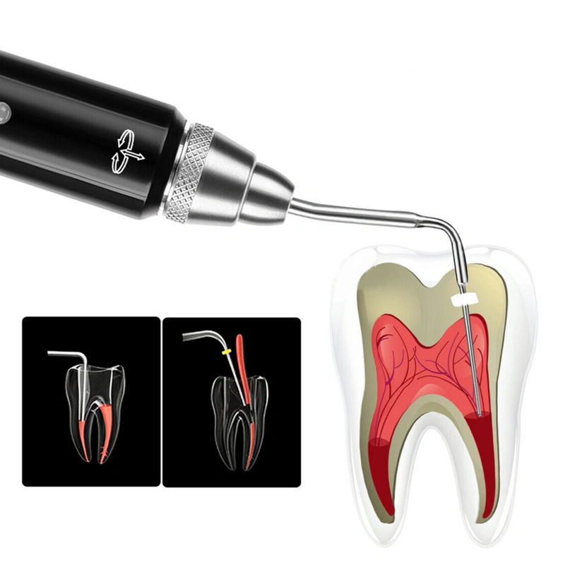 Dental Endodontic Cordless Gutta Percha Heated Plugger Needle ...