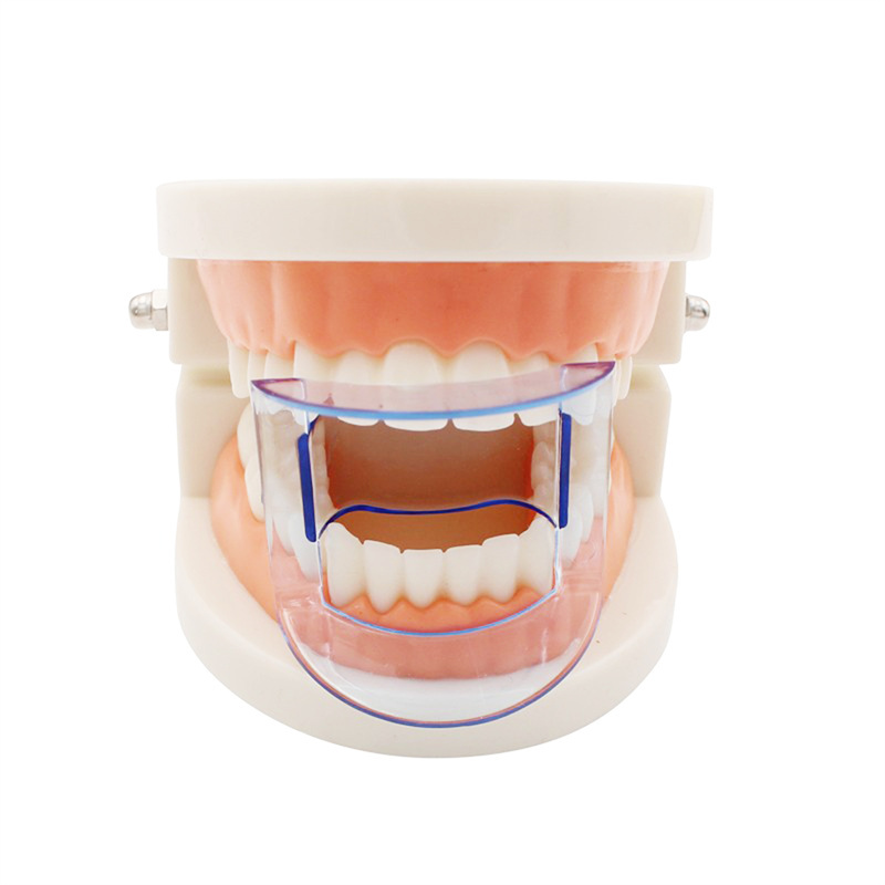 Dental Anterior/Posterior Mouth Opener Bite Prop Lip Retractor Cheek ...