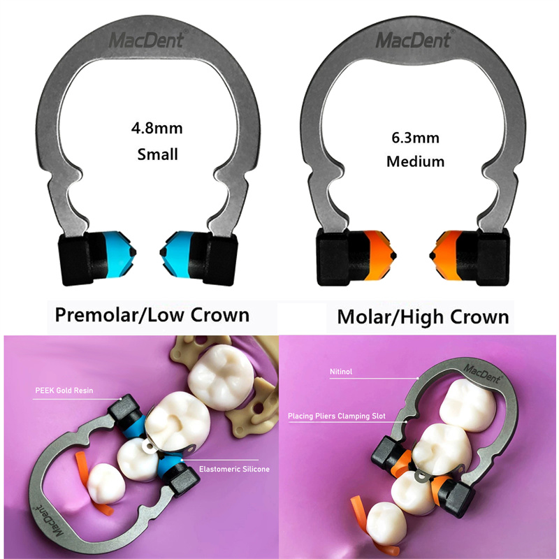 `MacDent Dental Sectional Contoured Metal Matrice Matrix Refill Medium ...