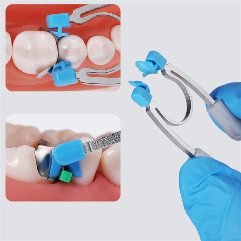 Dental Sectional Matrix System Matrices Metal Bands 30 Pcs Kit + Clip ...