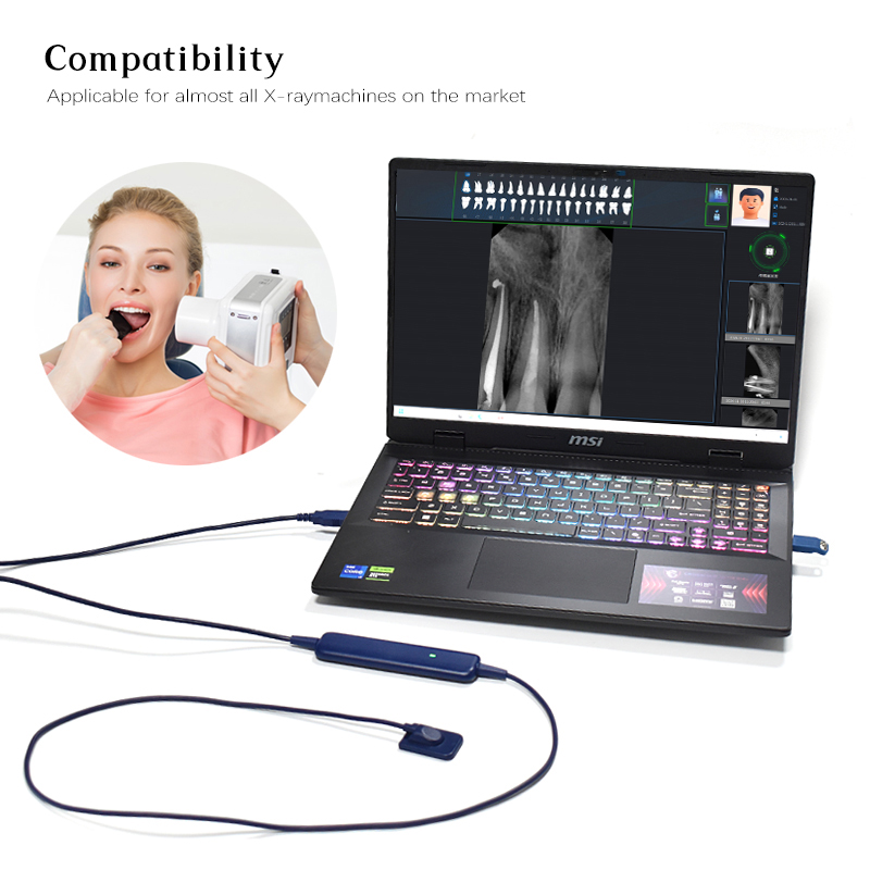 Dental CMOS / APS Digital Ray Imaging System Intraoral HD Sensor