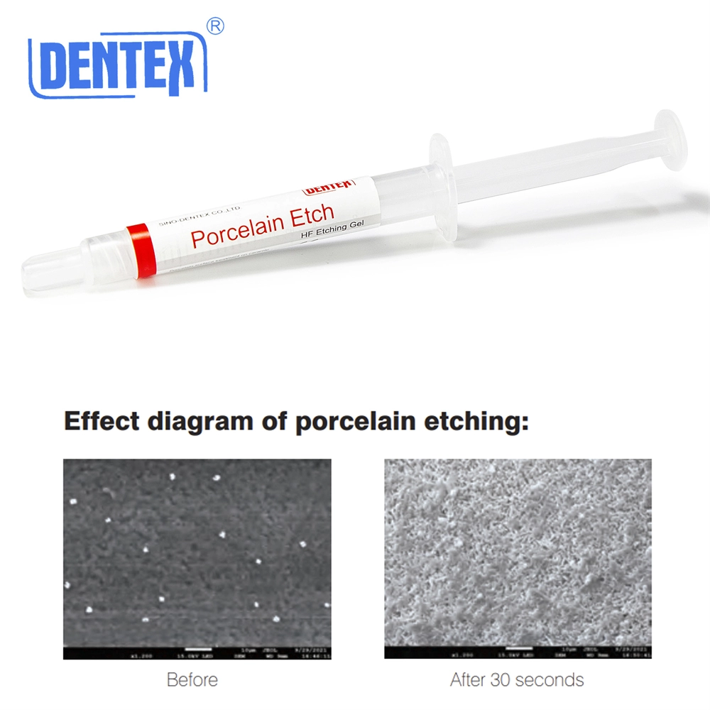 Dentex Dental Porcelain Etch Gel 9.5% Hydrofluoric Acid Etchant Syringe ...
