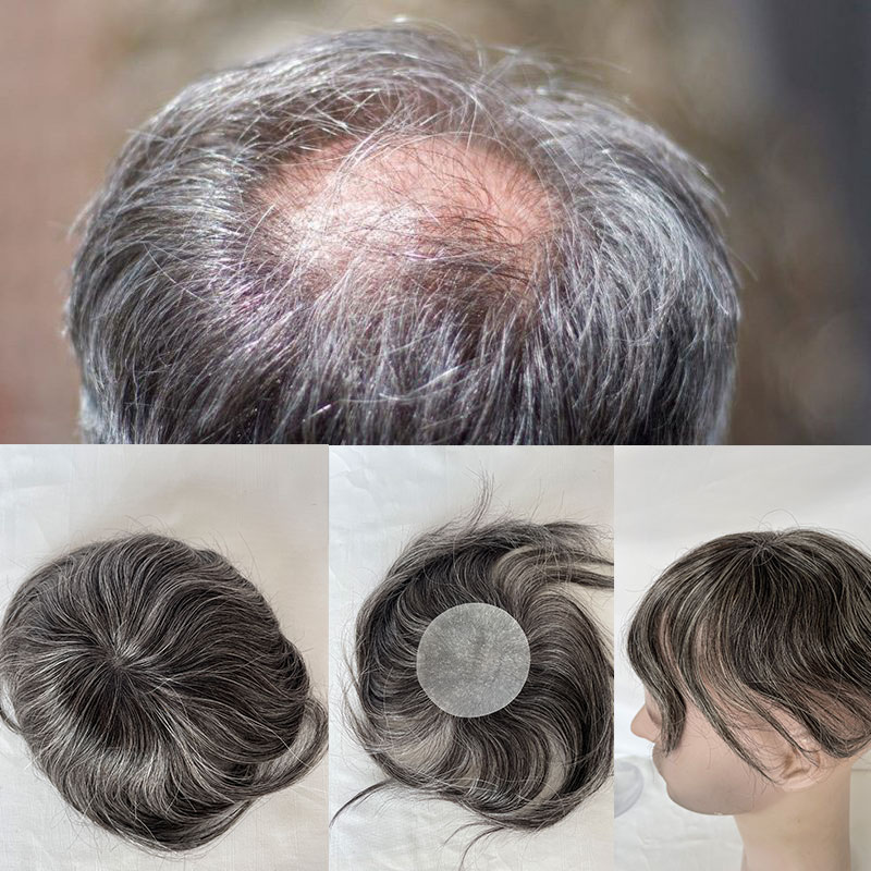 Thin Skin PU Bald Spot Hair Patches Toupee For Men 8CM X 8CM V-Looped ...