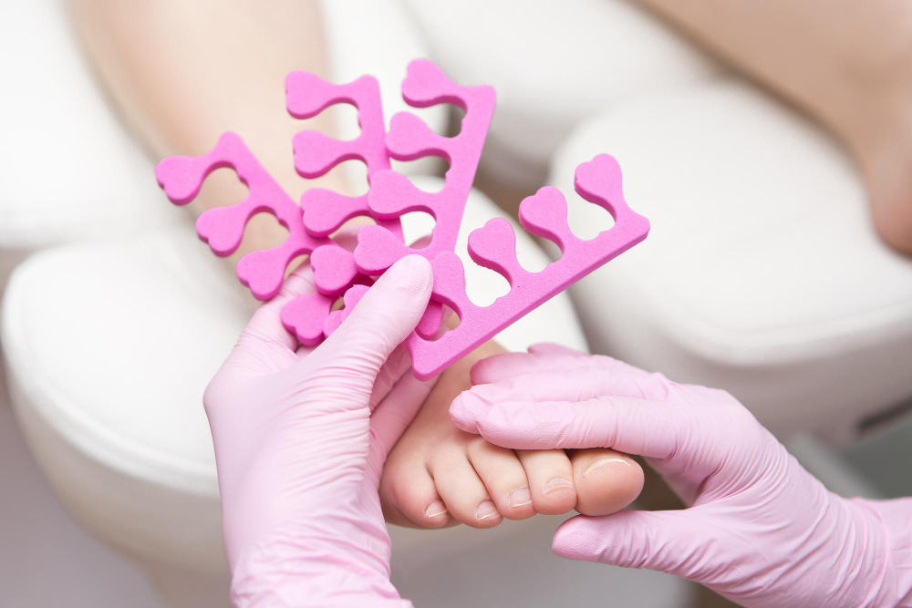 Why You Should Use Toe Separators