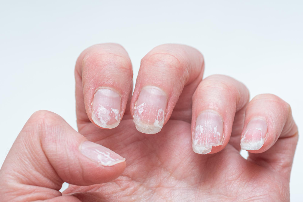 Perfect Your Nail Care: The Importance of Choosing the Right Nail File