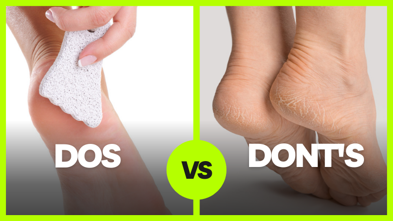 Do's and Don'ts For Caring Dry; Cracked; Calloused Feet