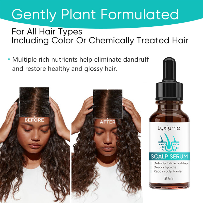 Scalp Treatment Hydrating Serum Promote Scalp Circulation Detoxify ...