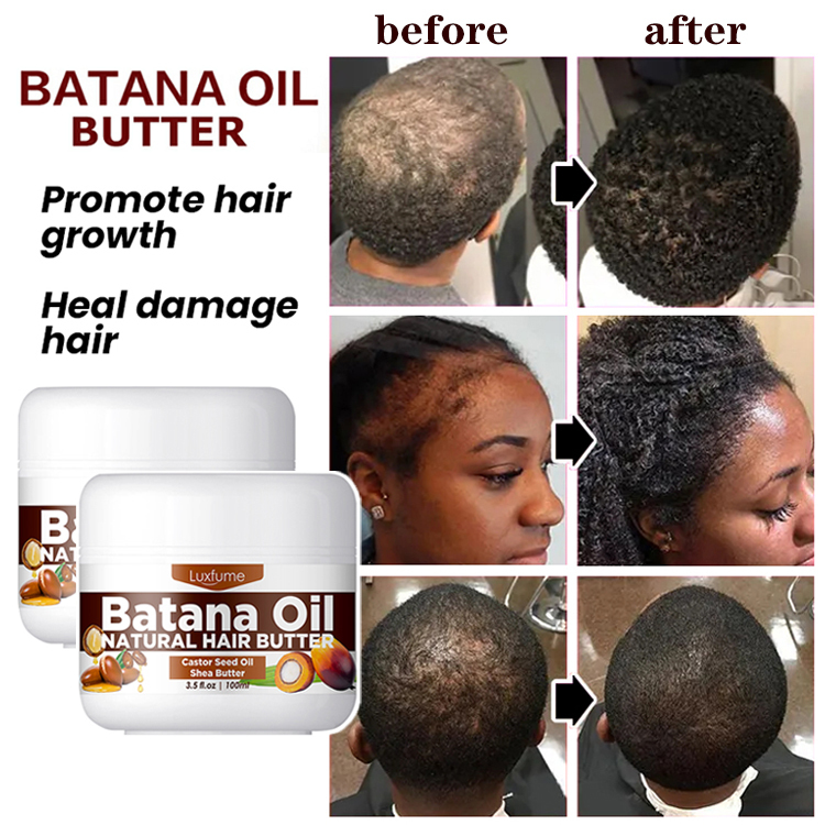 Prevent Hair Loss Batana Oil Hair Butter Cream For Hair Growth