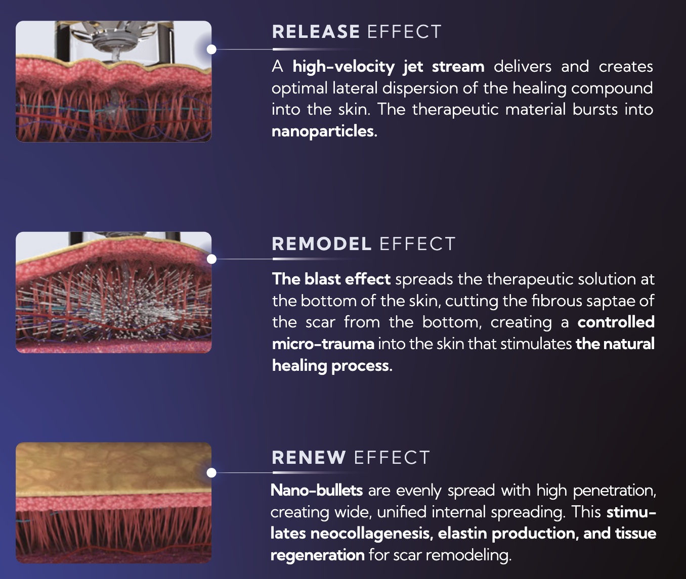 EnerJet Console,Injector Mesotherapy