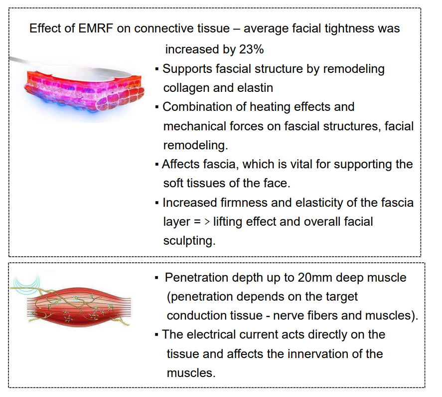 EMRF High-intensity Facial Electromagnetic Stimulation HIFES Mono-polar ...