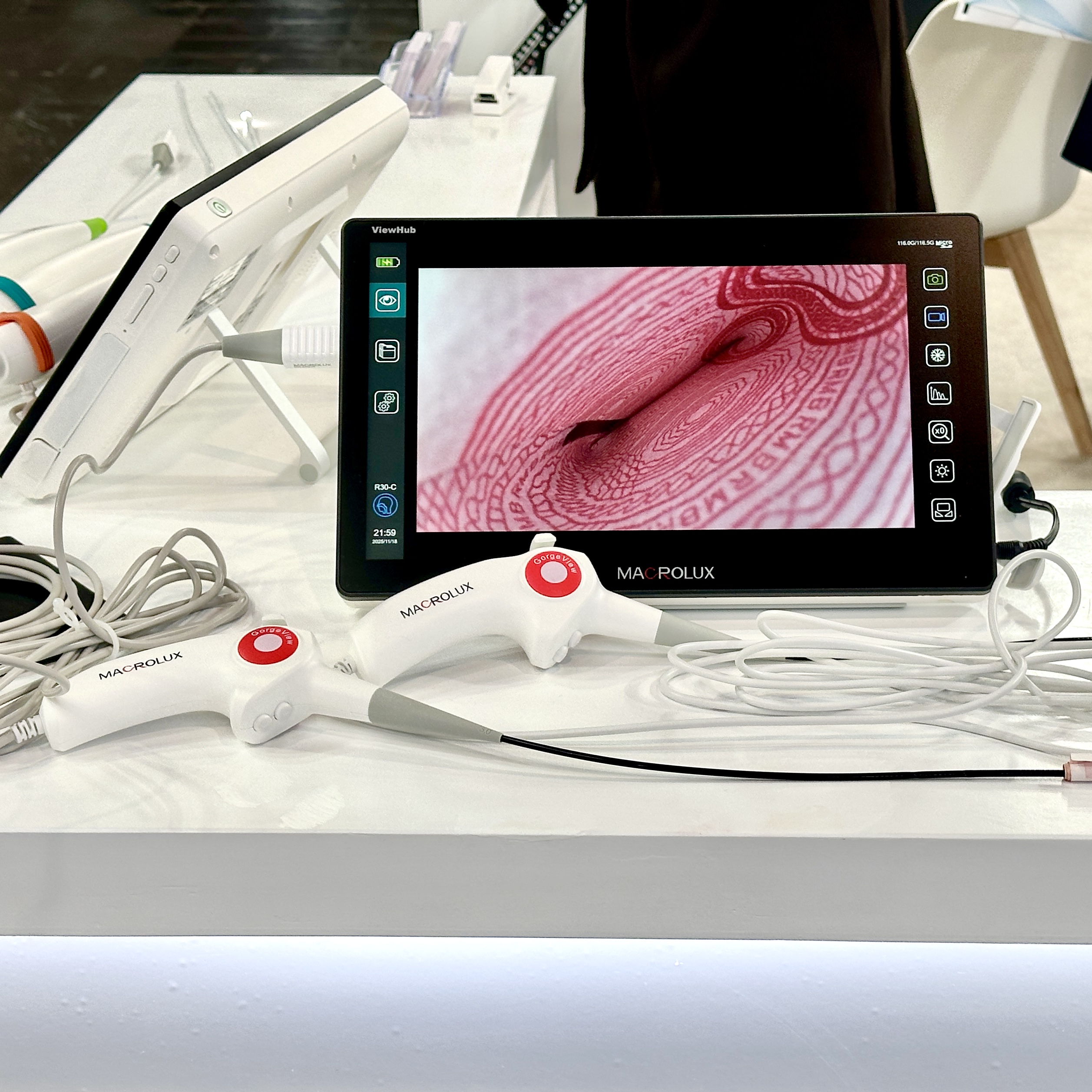 MacroLux Medical Showcases Innovative Endoscopy Portfolio at MEDICA 2025