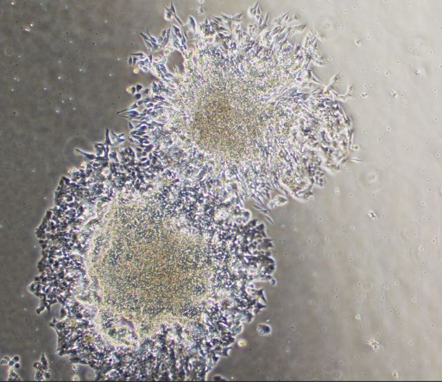 MeltonVEC™-Sendai iPSC Reprogramming Kit (Normal)