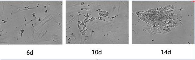 MeltonVEC™-iPSC Reprogramming Kit (iPSC重编辑试剂盒）